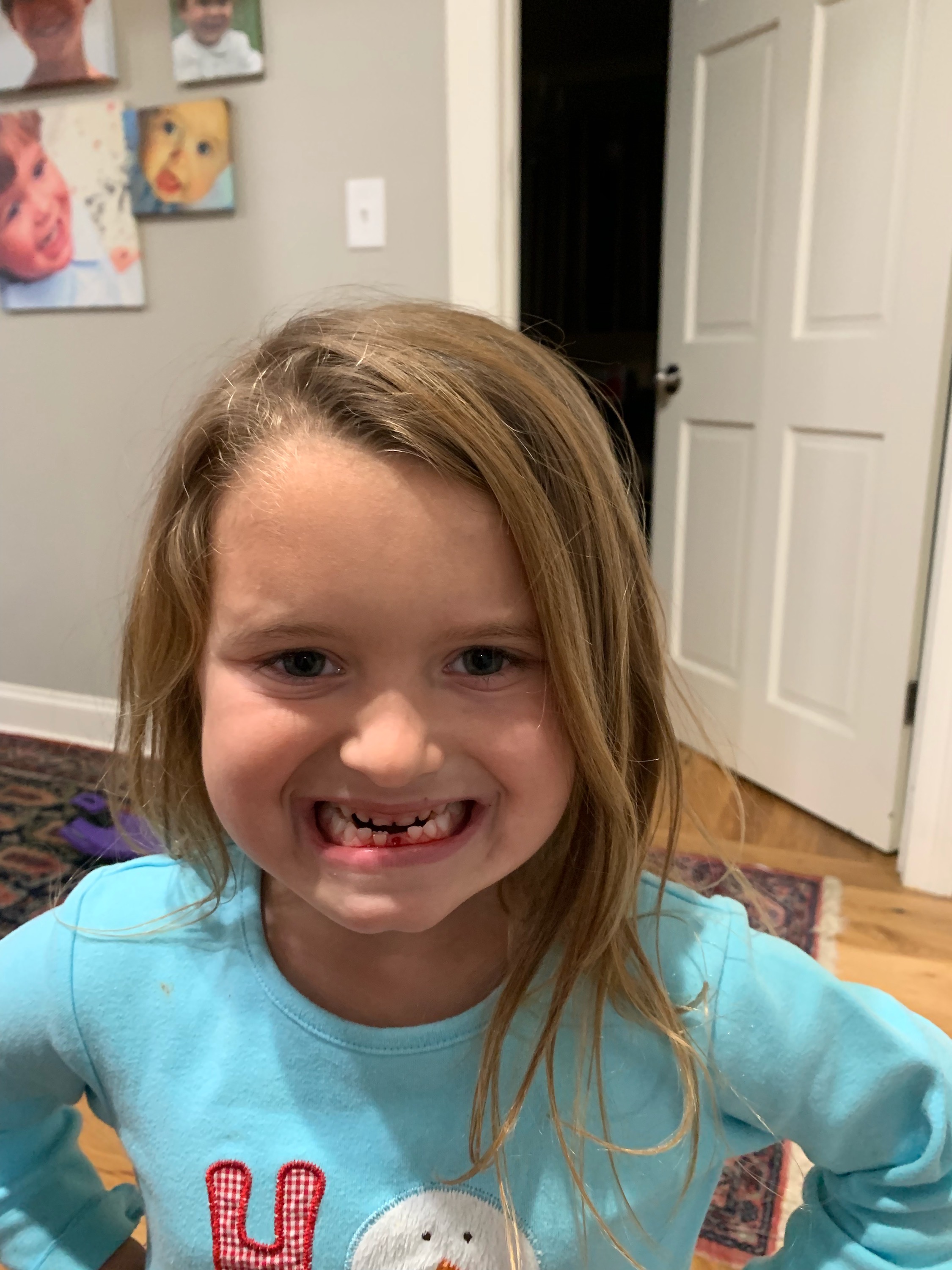 Teeth | uglyreal